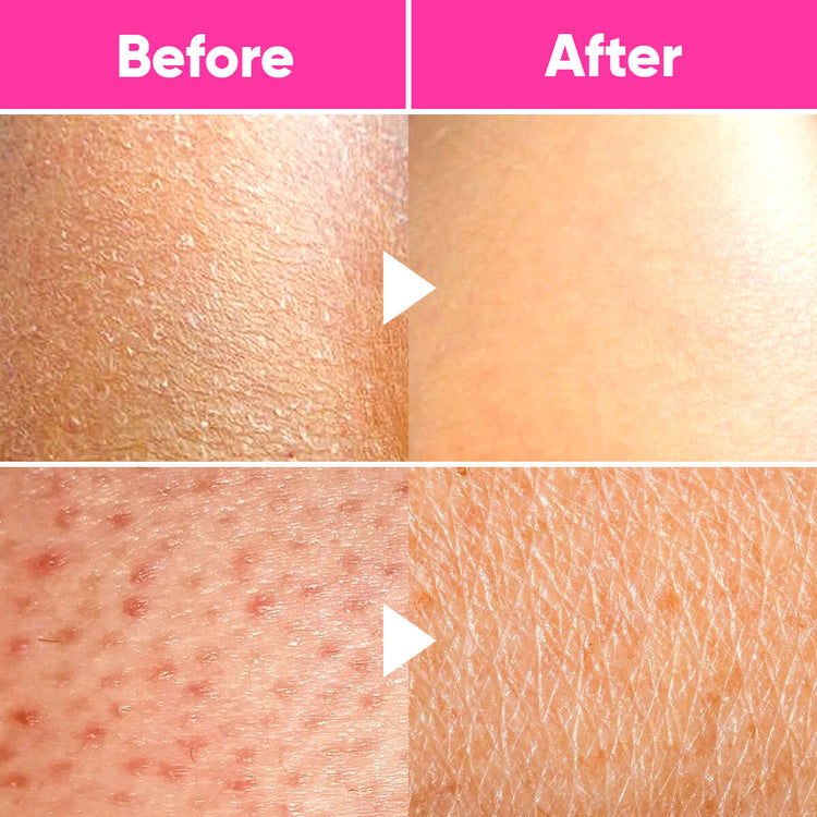 So Silky Mitt™️ | 100% Pure Silk Body Exfoliator – AmePure.eu